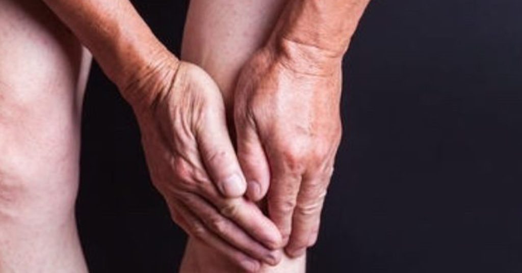 Five Facts You Should Know About Arthritis | Palmetto Bone and Joint