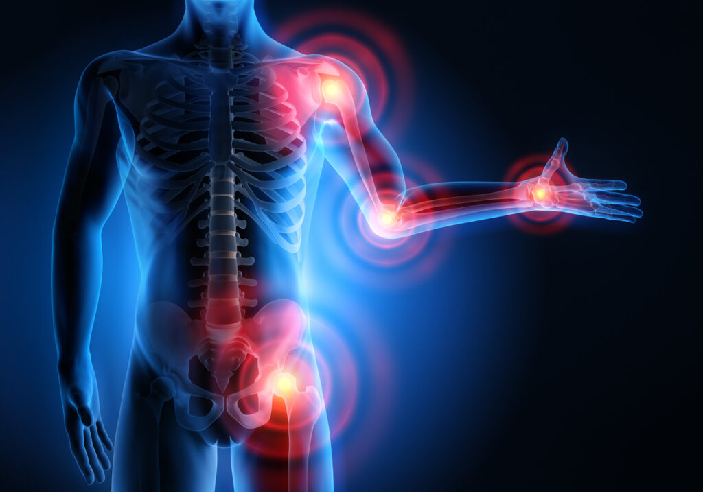 When to See an Orthopedic Doctor | Palmetto Bone & Joint